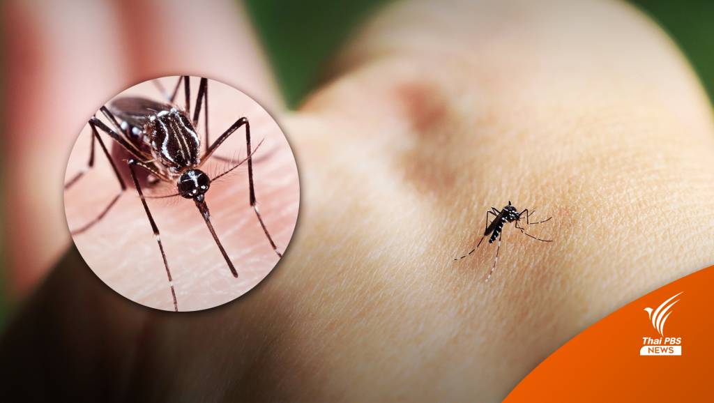 Open 3 mechanisms to transform from "Mosquito" to "Super Mosquito ...